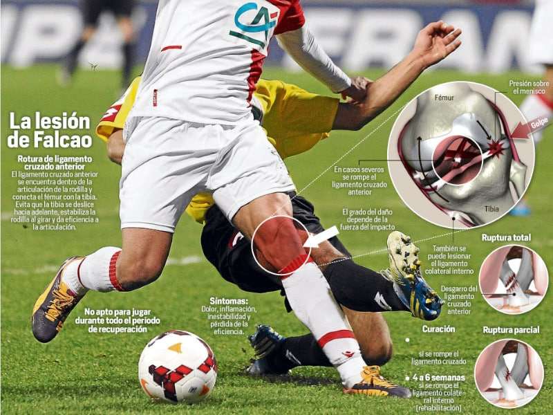 ¿Cómo evitar lesiones en las rodillas al practicar fútbol? - Diario Murcia